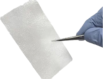 XCELL Amnio Matrix™ – Lyophilized Amniotic Allograft